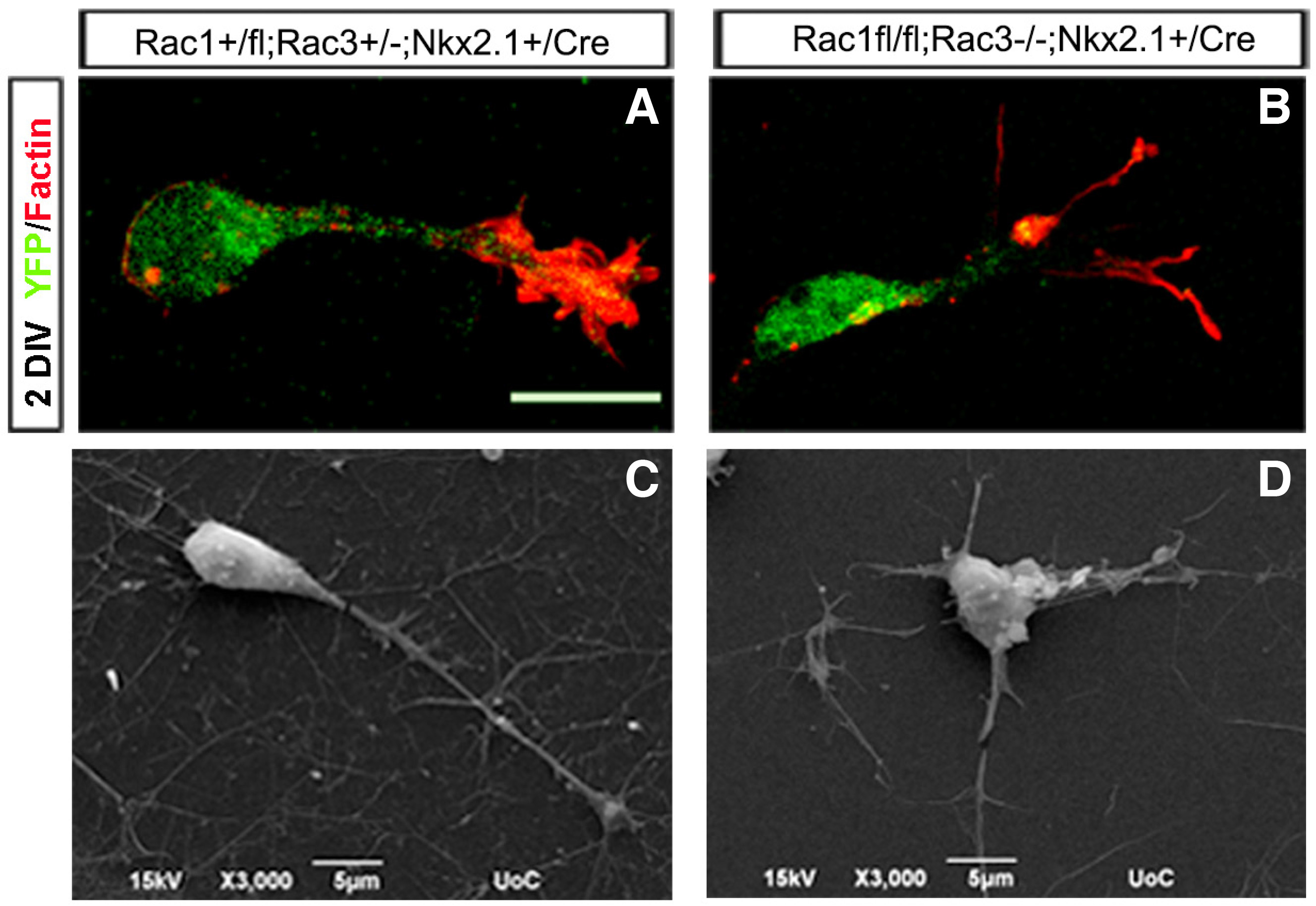 Cortical interneuron development: a role for small Rho GTPases | The ...