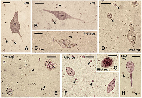 RNA and proteins extracted from the regenerating tail of lizards ...